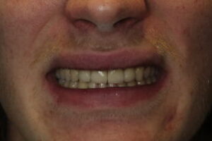 Galerie - Dentisterie à l'étranger à un prix abordable