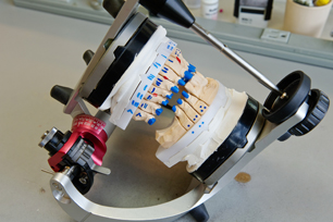 Arcus-Digma 2 – Dentisterie cosmétique avancée — Kreativ Dental®