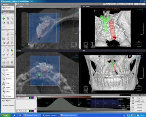 CT- scan — Kreativ Dental®